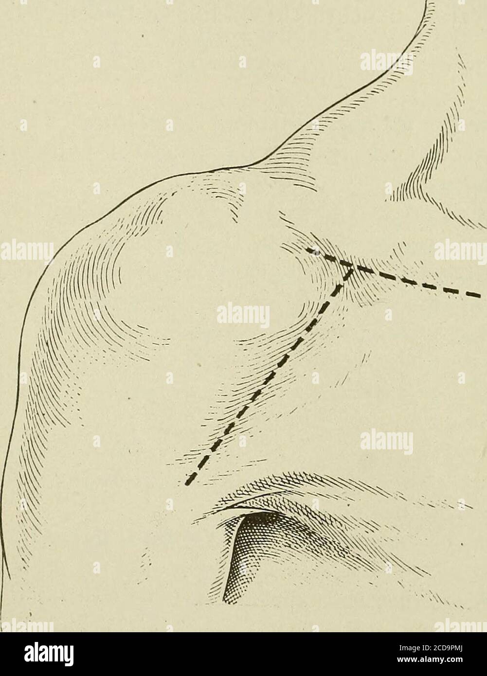 . Medical and surgical therapy . y closed with pressure forceps. In the ...