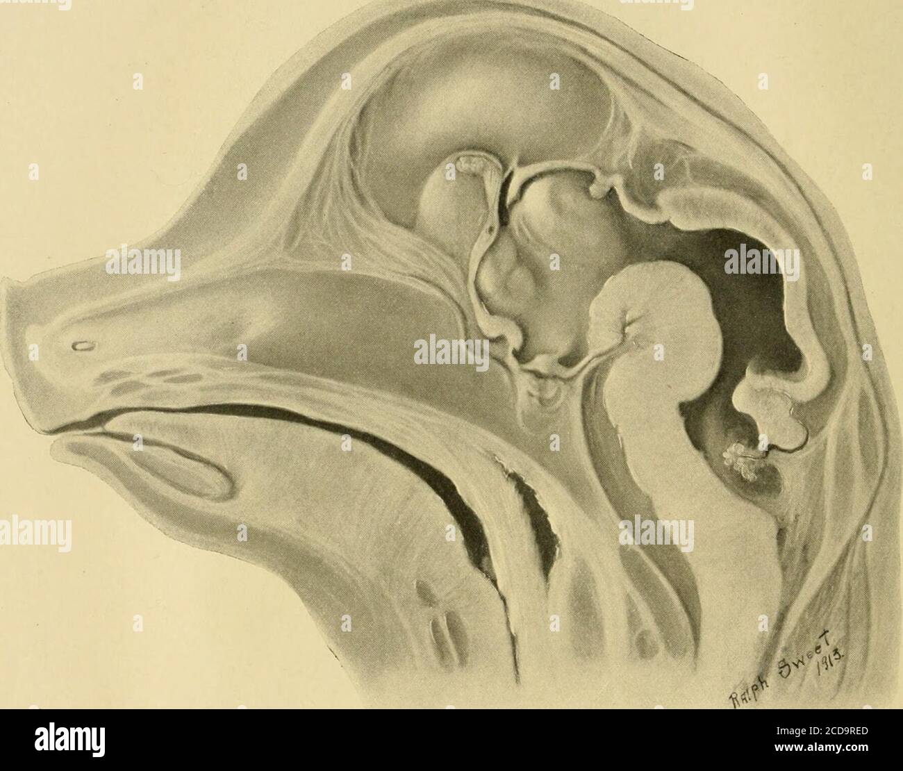 . Journal of comparative neurology . Fig. 79 Pig embryo, 28 mm. The ...