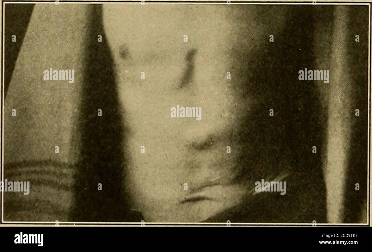 Epigastric region hi-res stock photography and images - Alamy