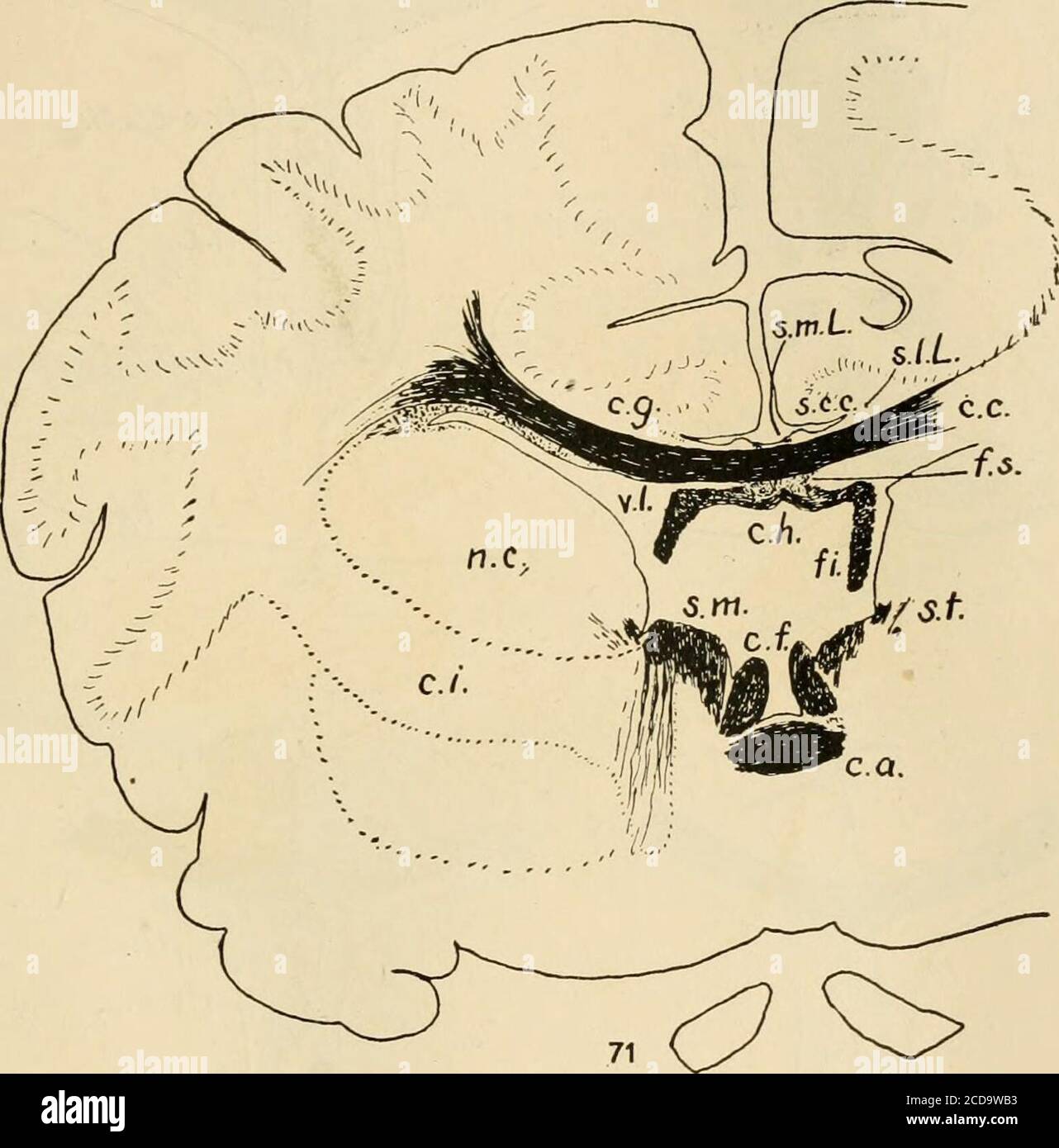 Interventricular Septum Brain