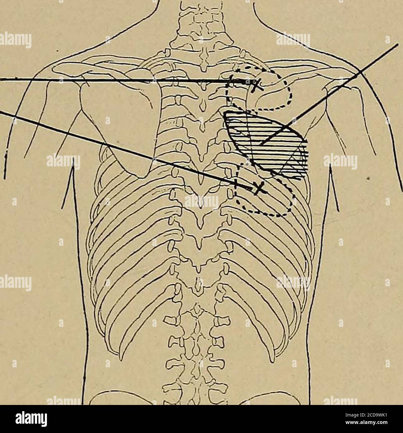 11 pus years hi-res stock photography and images - Alamy