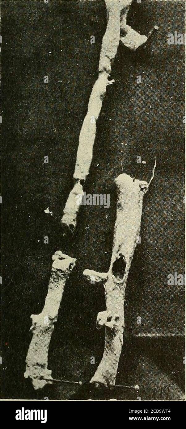 . Medical and surgical therapy . Fig. 1.—Bullet-wound of the iieckwith ...