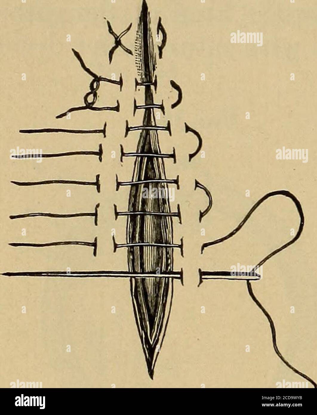 . Minor and operative surgery, including bandaging . d or continued ...