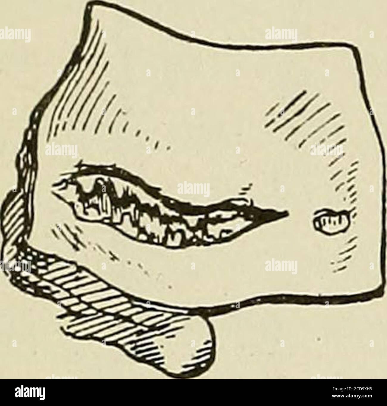 Internal lacerations hi-res stock photography and images - Alamy