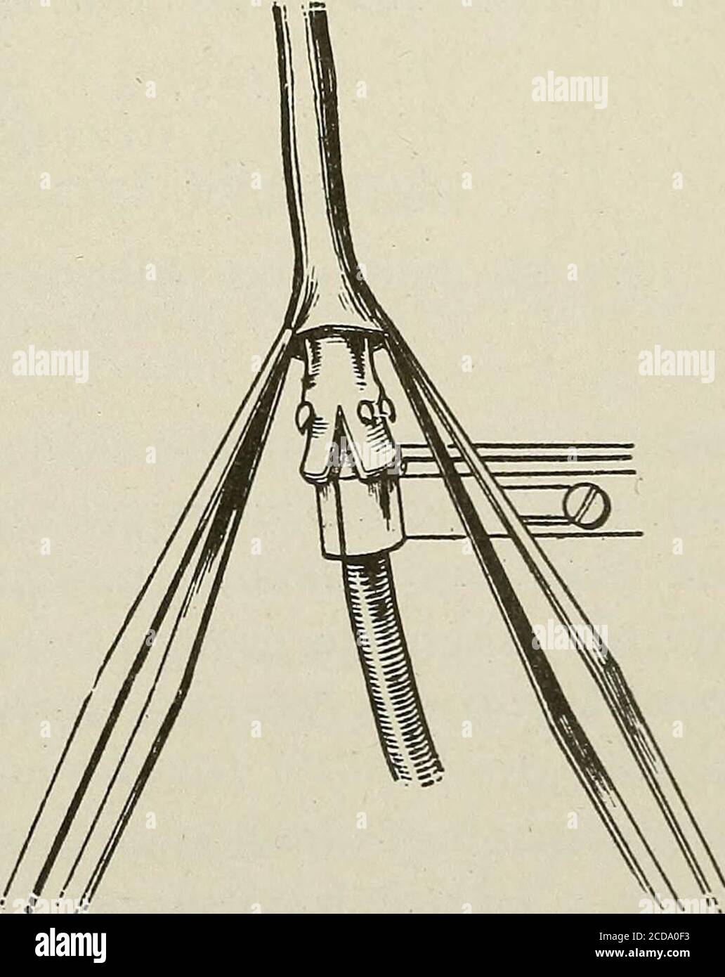 Canulae hi-res stock photography and images - Alamy