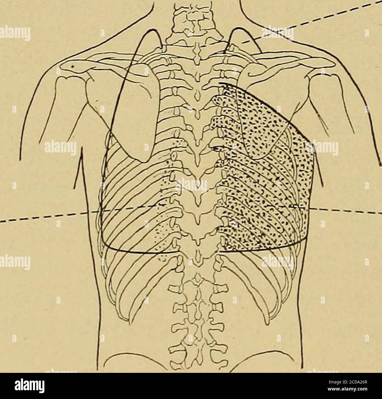 . Physical diagnosis . of the consolidated areawithout tiring the ...