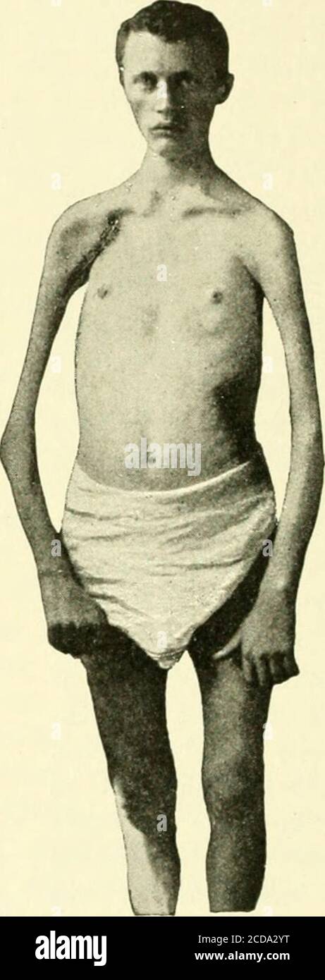 . A text-book of medicine for students and practitioners . Fig. 181 ...