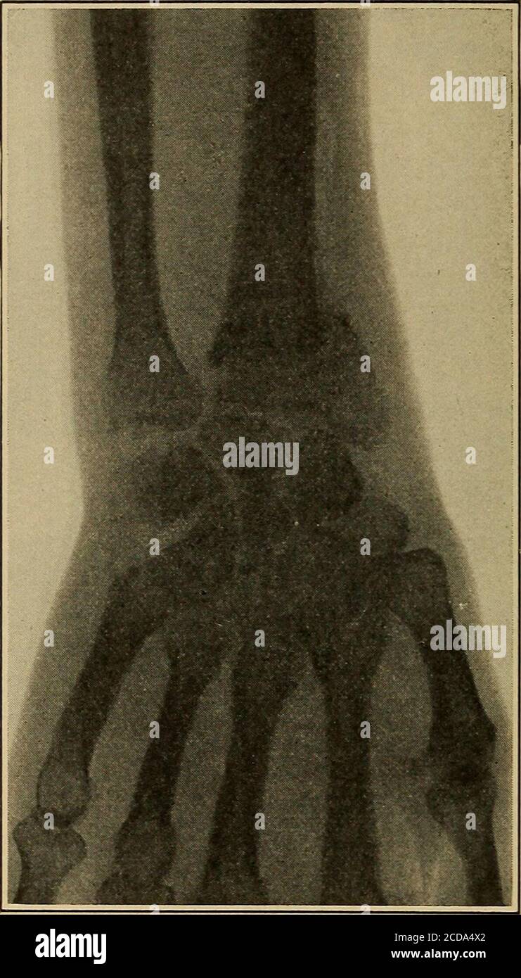 . Minor and operative surgery, including bandaging . 1 Apparatus for ...