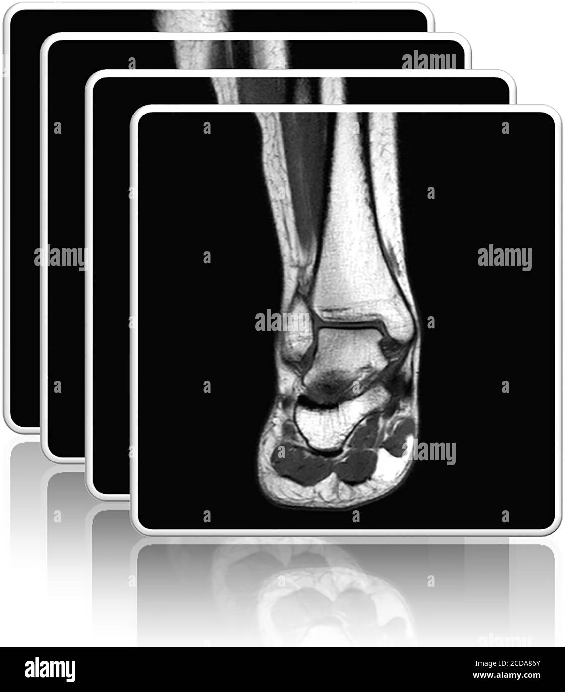 MRI of the foot and ankle Stock Photo - Alamy