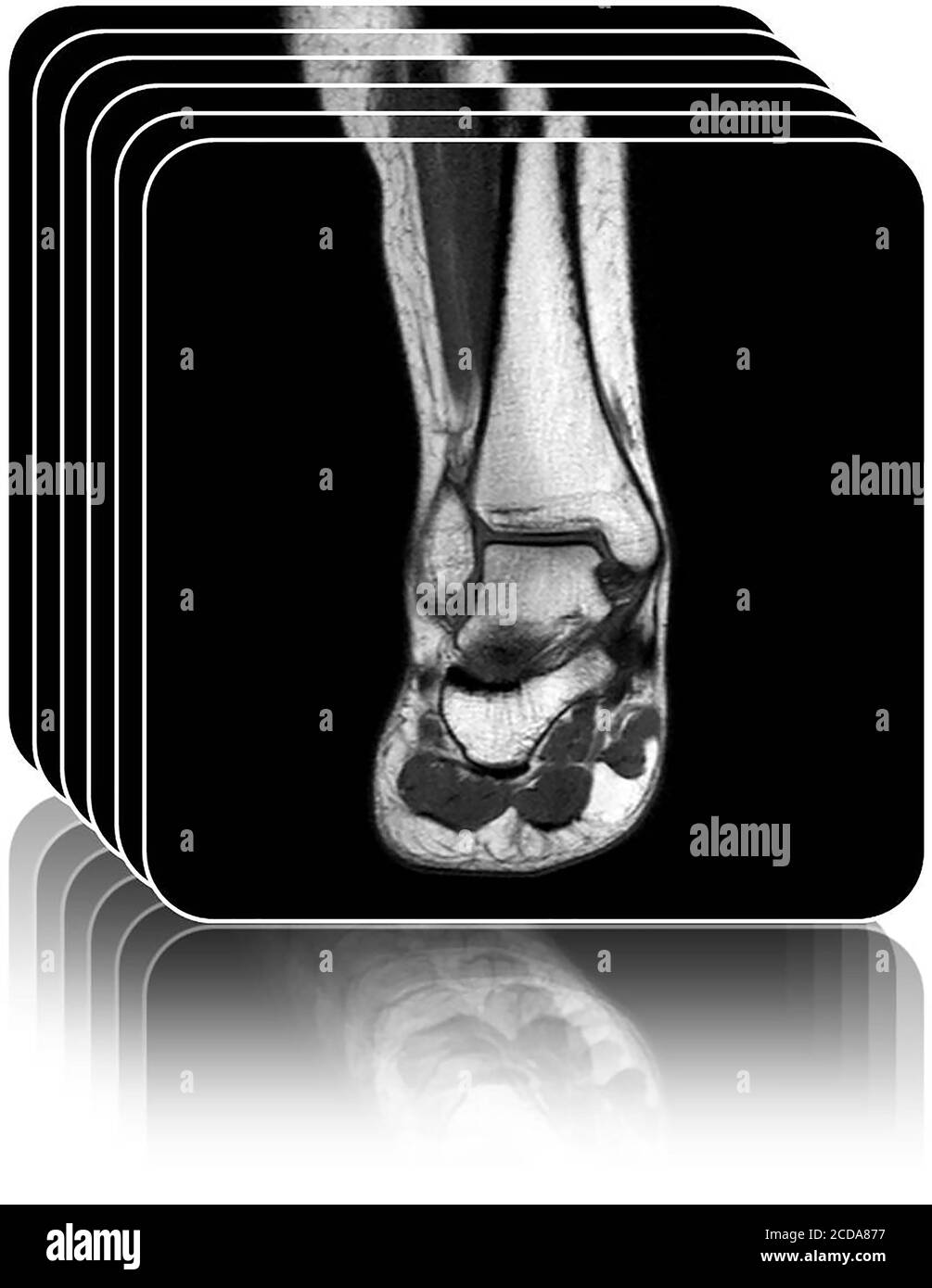 MRI of the foot and ankle Stock Photo - Alamy
