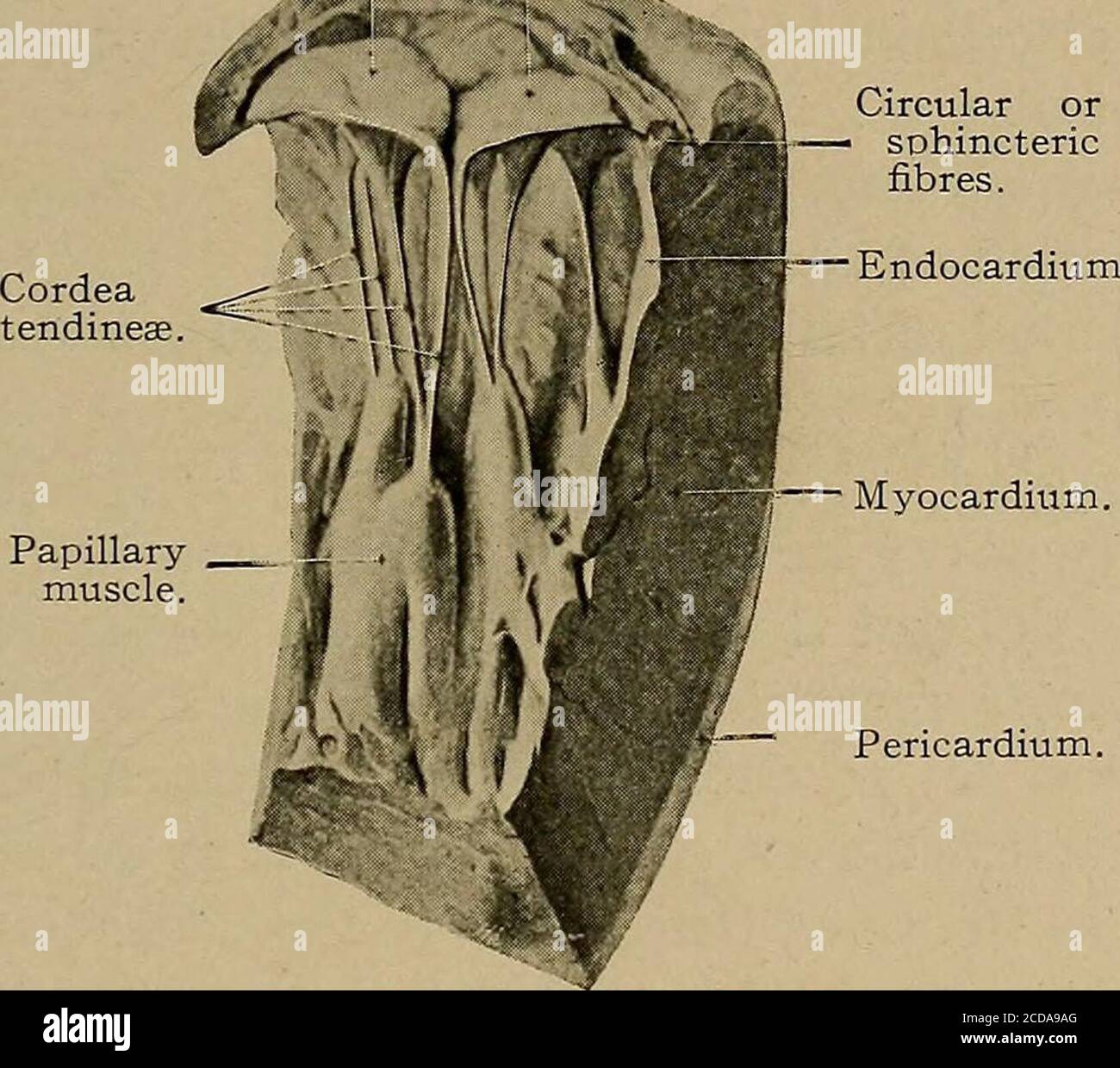 Papillary Muscles
