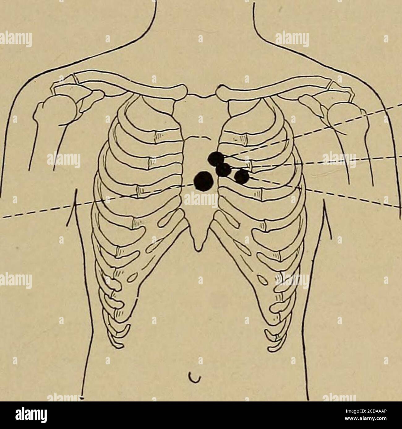 Cardiac Apex High Resolution Stock Photography and Images - Alamy