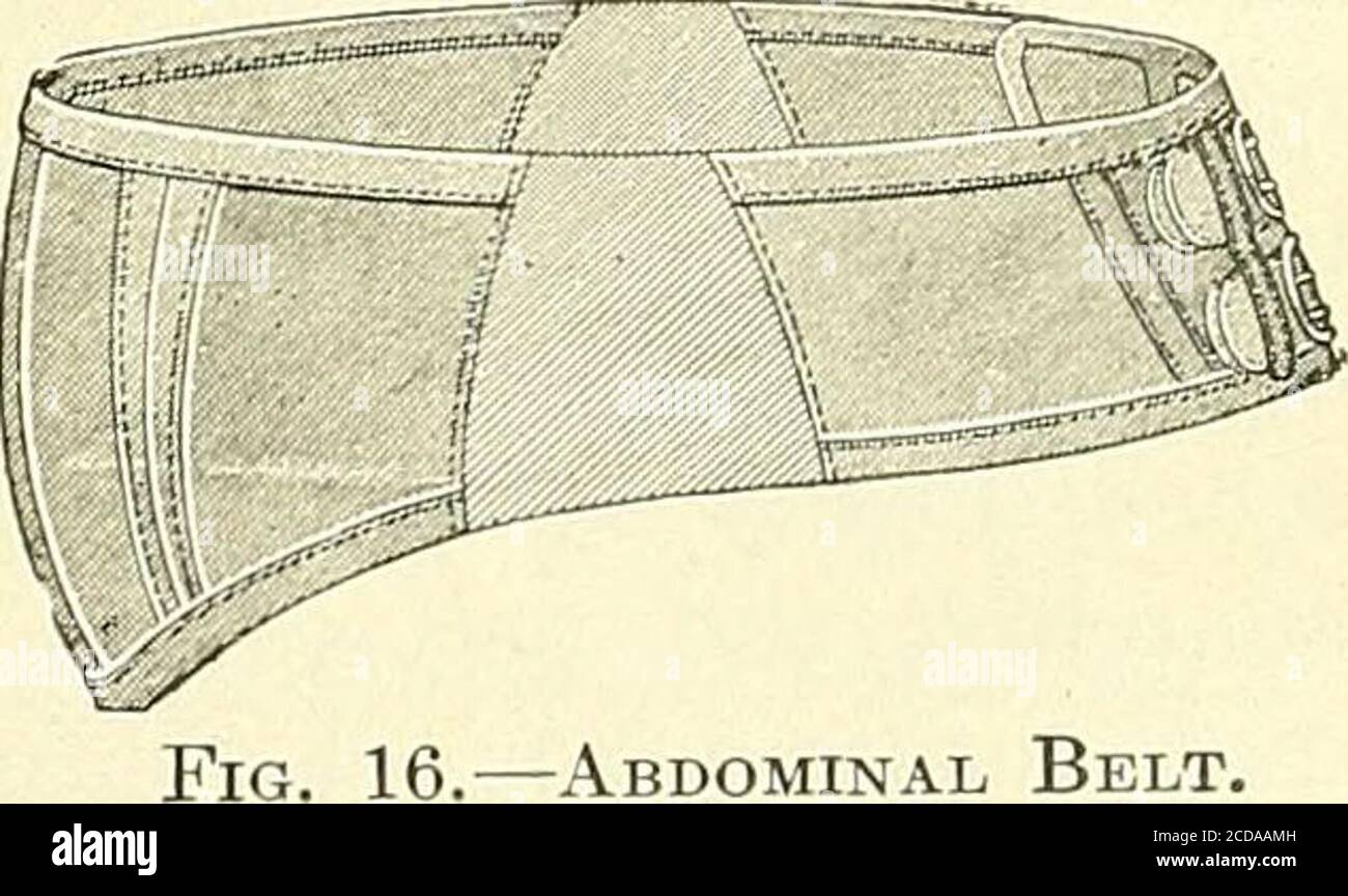 . Surgery, its principles and practice . Fig. 15.—The French Truss ...