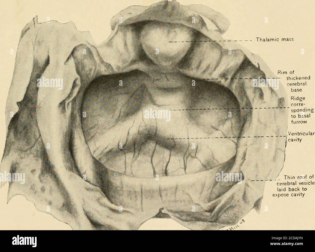 . Journal of comparative neurology . Anterior limb ofbasal furrow Roof ...
