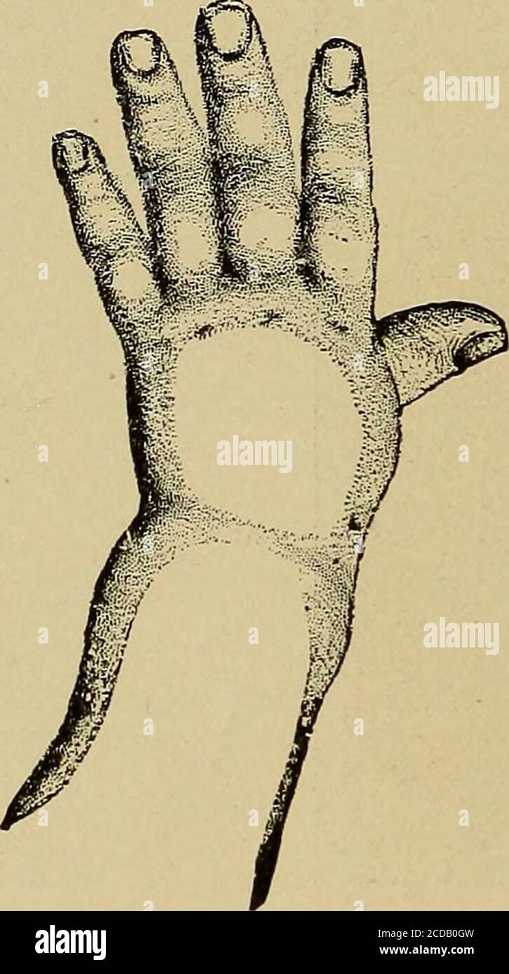 . Physical diagnosis . es the local reaction after the ...