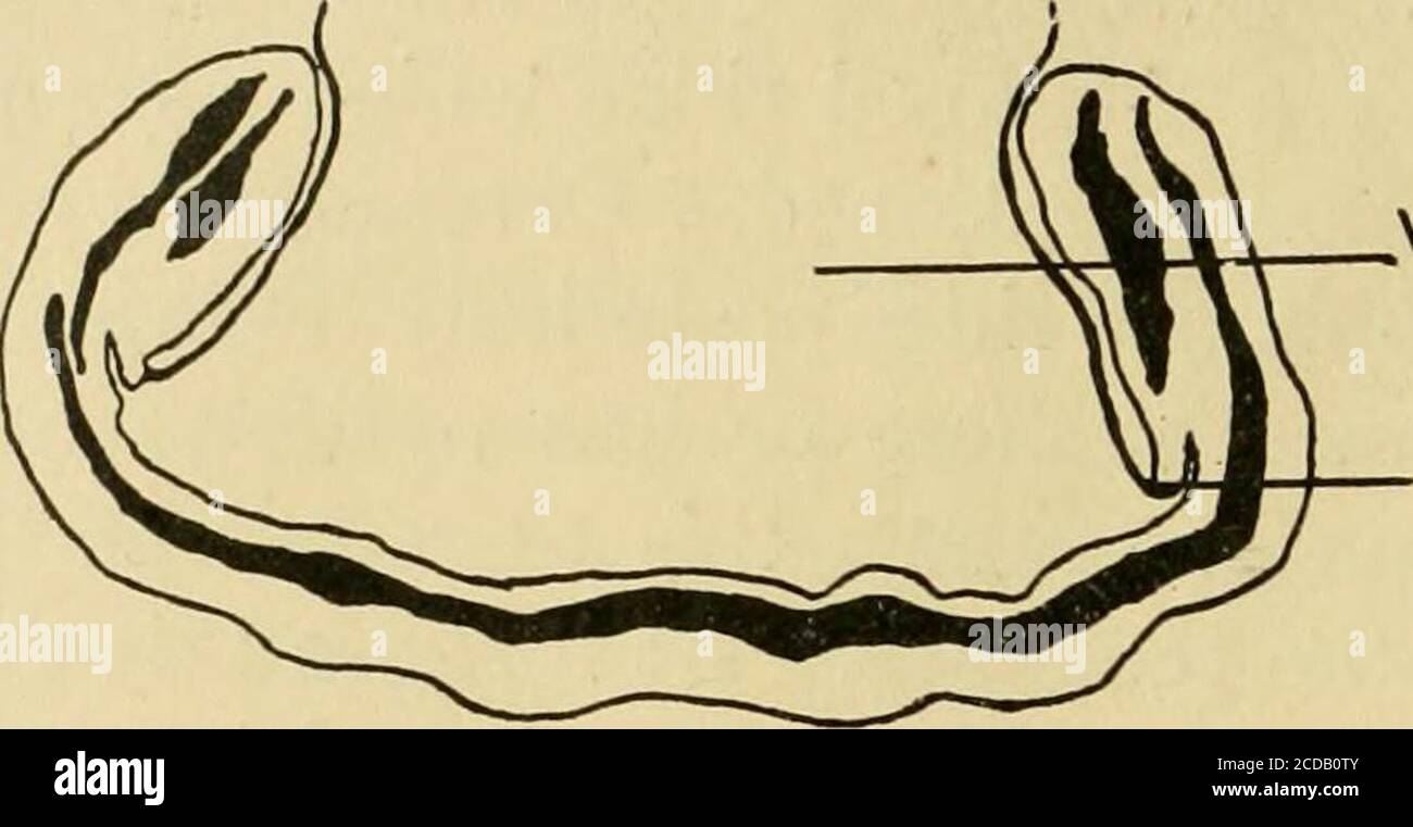 Habenular nucleus hi-res stock photography and images - Alamy