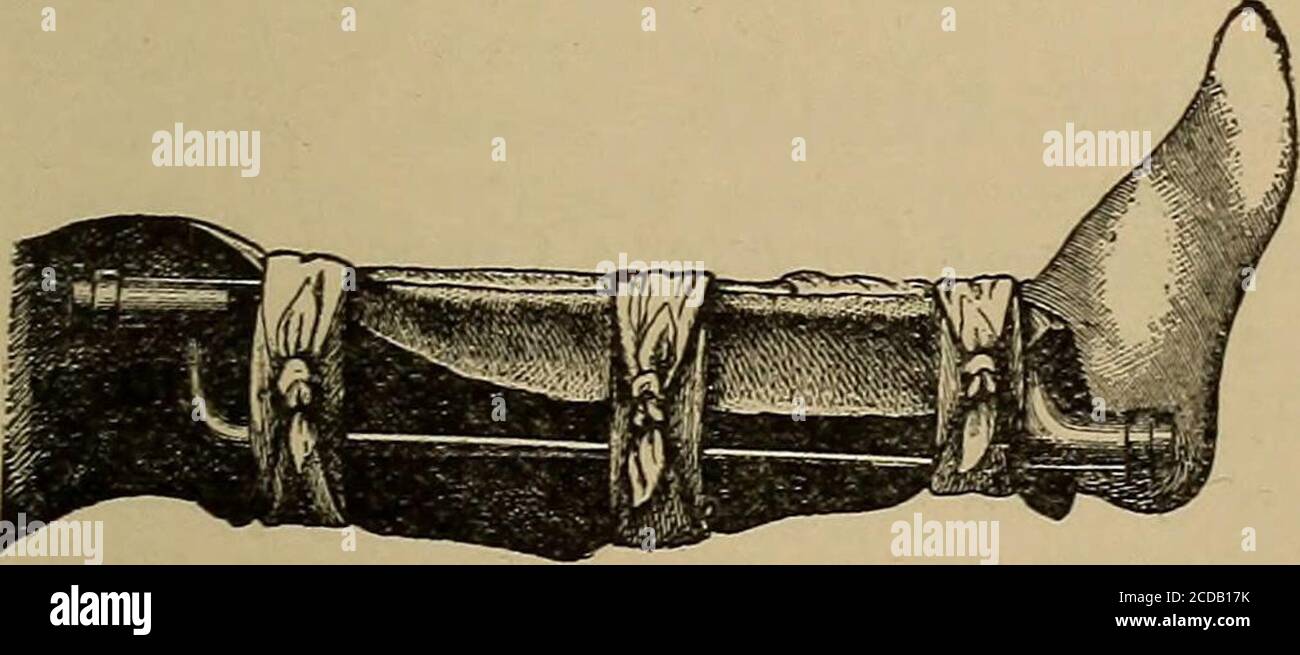 . First aid in illness and injury; . other boneforms a splint ...