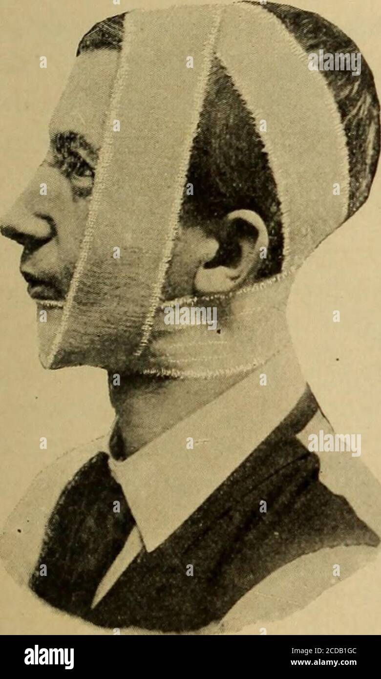 . Minor and operative surgery, including bandaging . ured by a pin ...