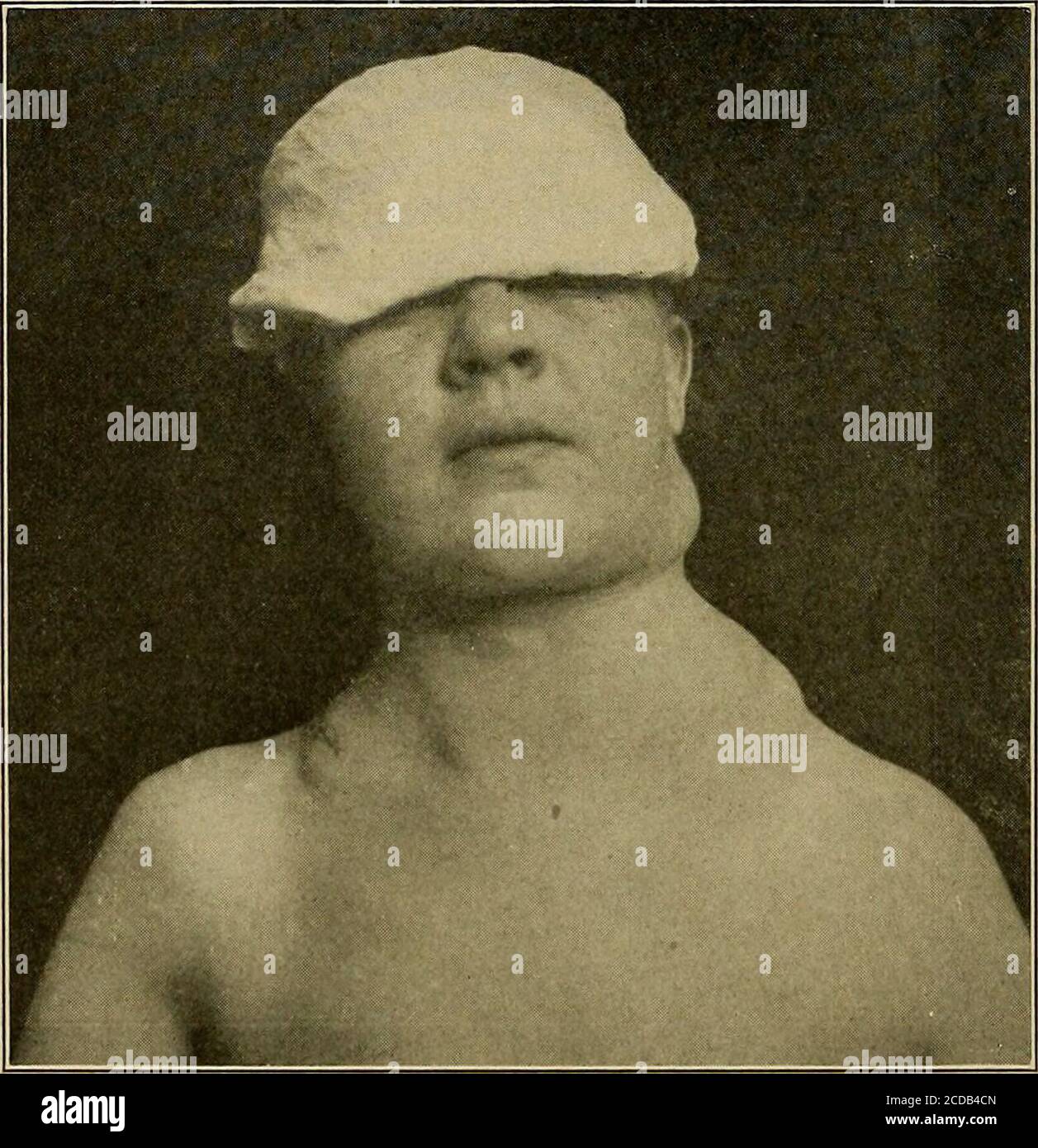 . Physical diagnosis . ). 2. Abscesses andscars. 3. Thyroid tumors. 4 ...