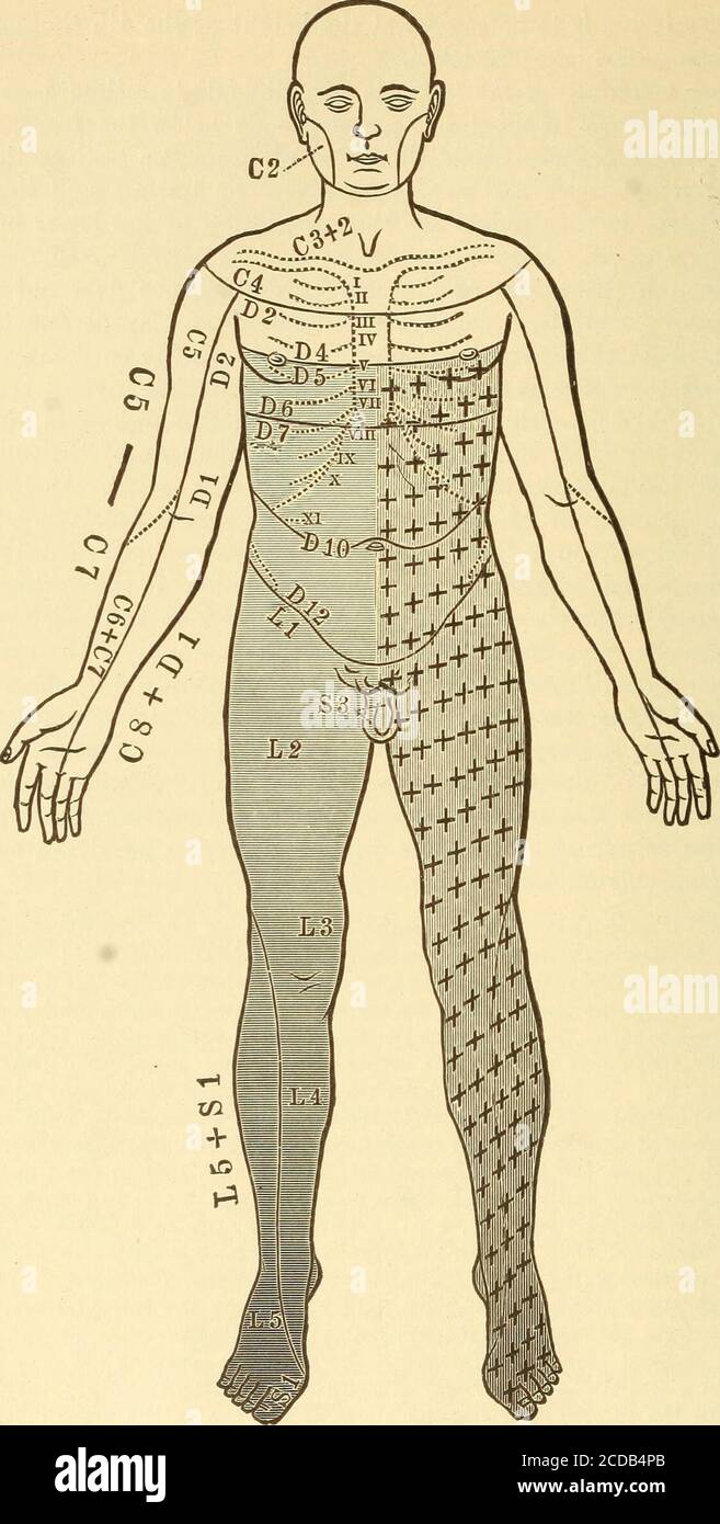. Diseases of the nervous system . with slight atrophy (inactivity ...
