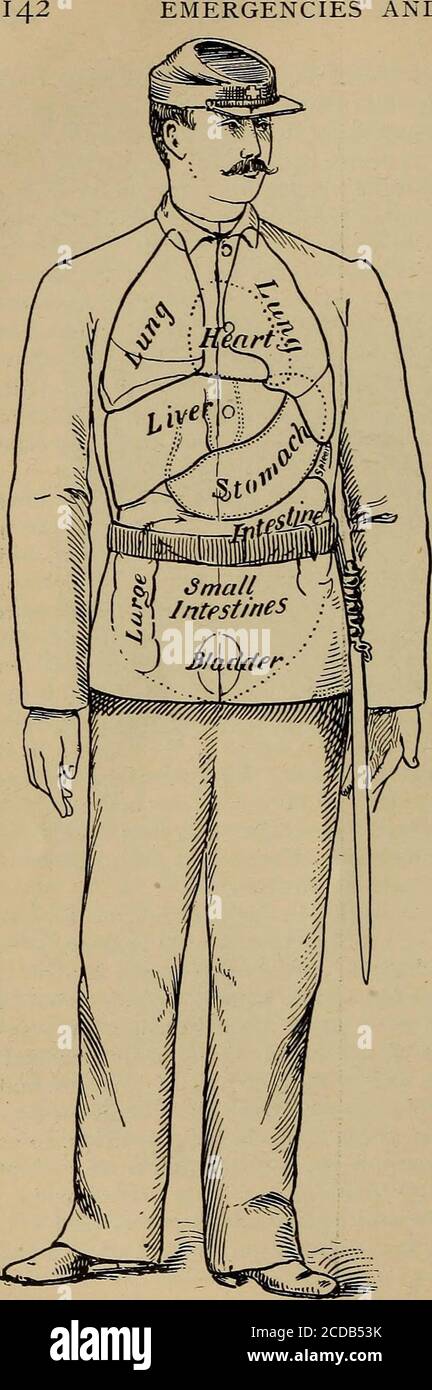 Spitting blood hi-res stock photography and images - Alamy