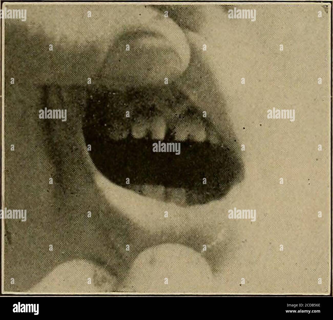 . Physical diagnosis . FiG. 21.—Diagram Showing theMonth at which Each ...