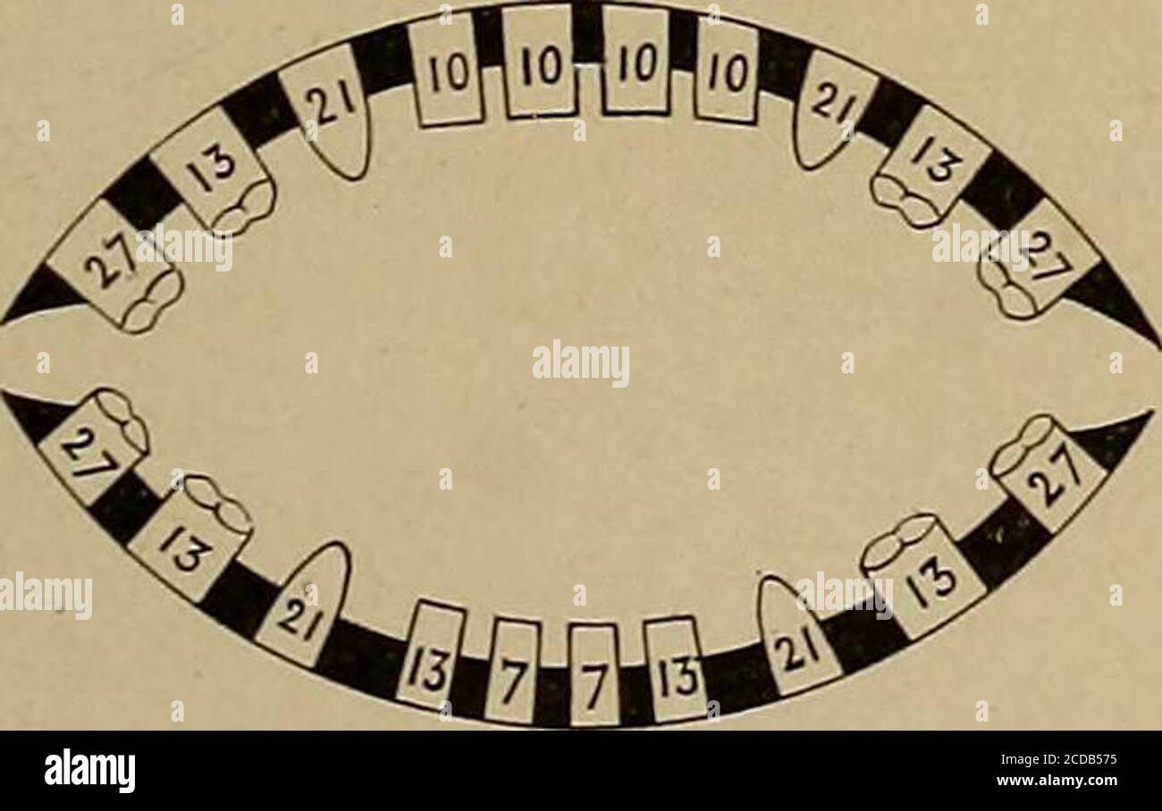 . Physical diagnosis . VIII. The Teeth. Fig. 20.—Angioneurotic (Edema ...