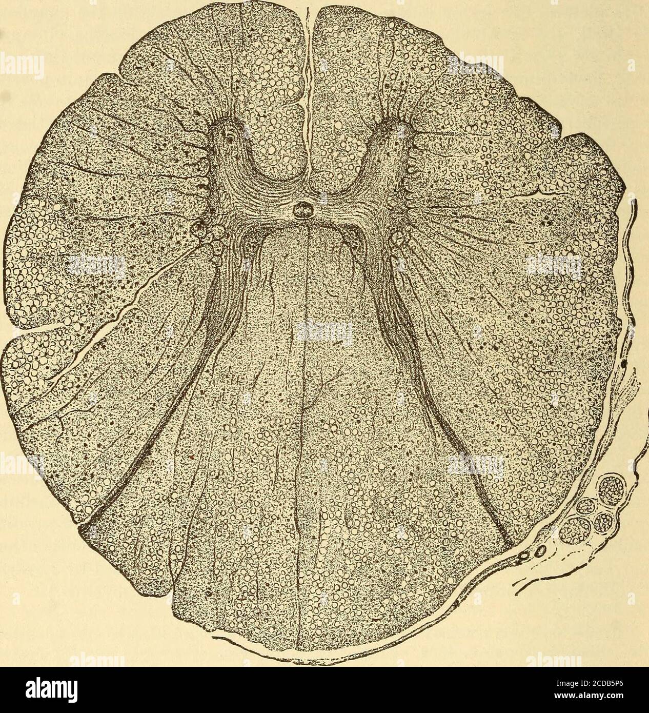 . Diseases of the nervous system . a moderately marked myelo-meningitis ...