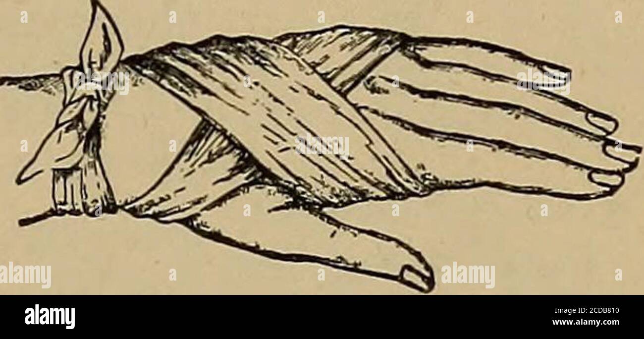 Triangular Bandage Techniques