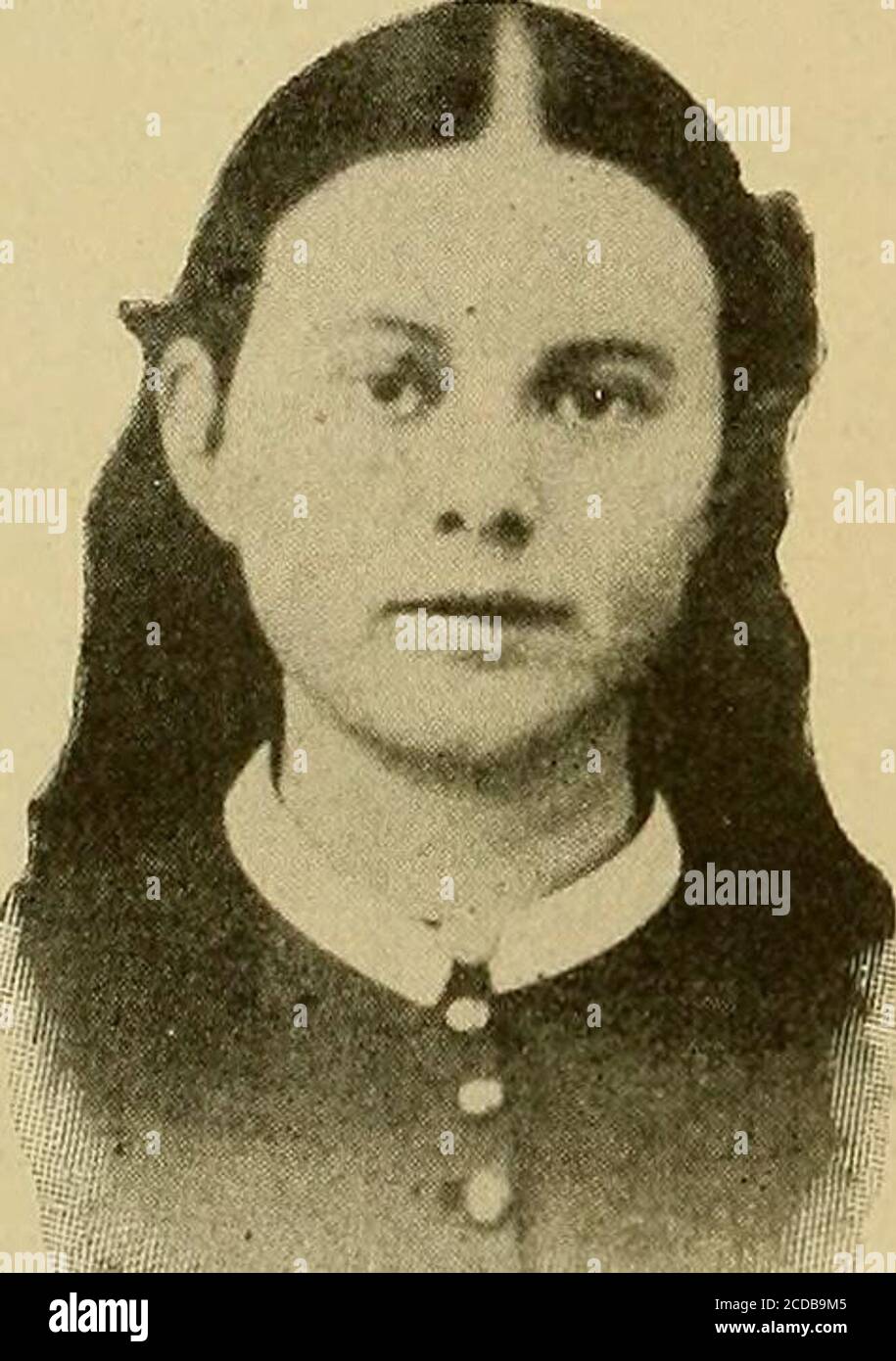 . Physical diagnosis . Fig. 1.—Hydrocephalus. 6 PHYSICAL DIAGNOSIS ...