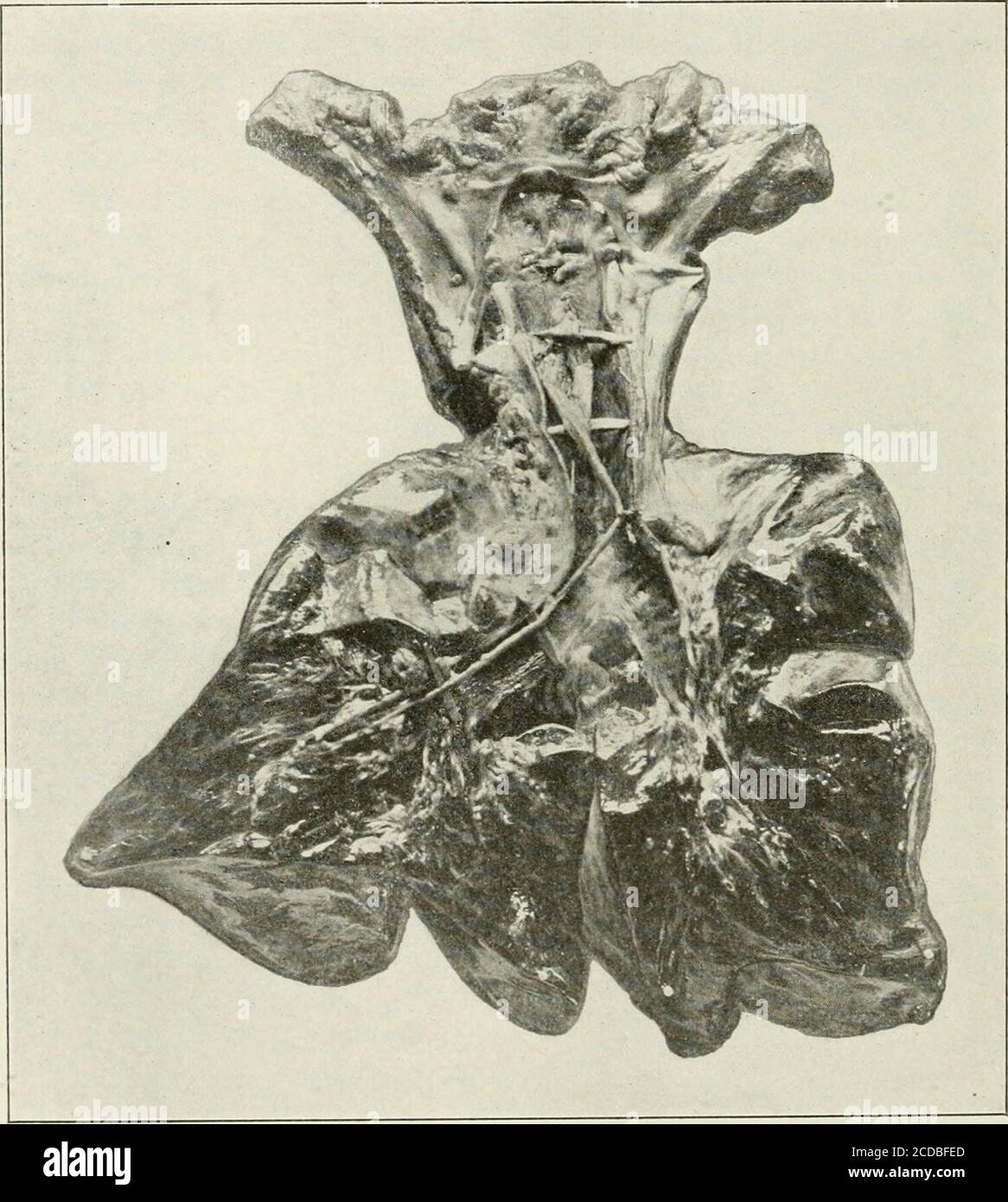 Trachea Mucous Membrane High Resolution Stock Photography and Images ...