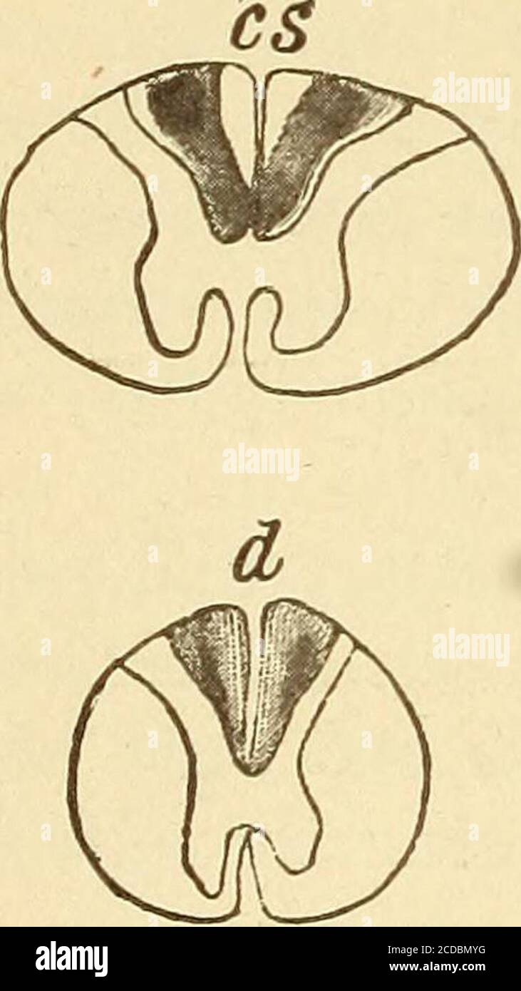 . Diseases of the nervous system . Fig. 100.—Posterior Roots (a) and ...
