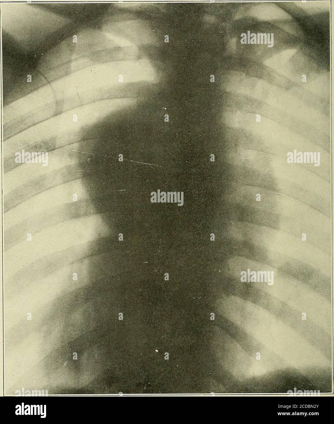 Fluoroscopy neck hi-res stock photography and images - Alamy