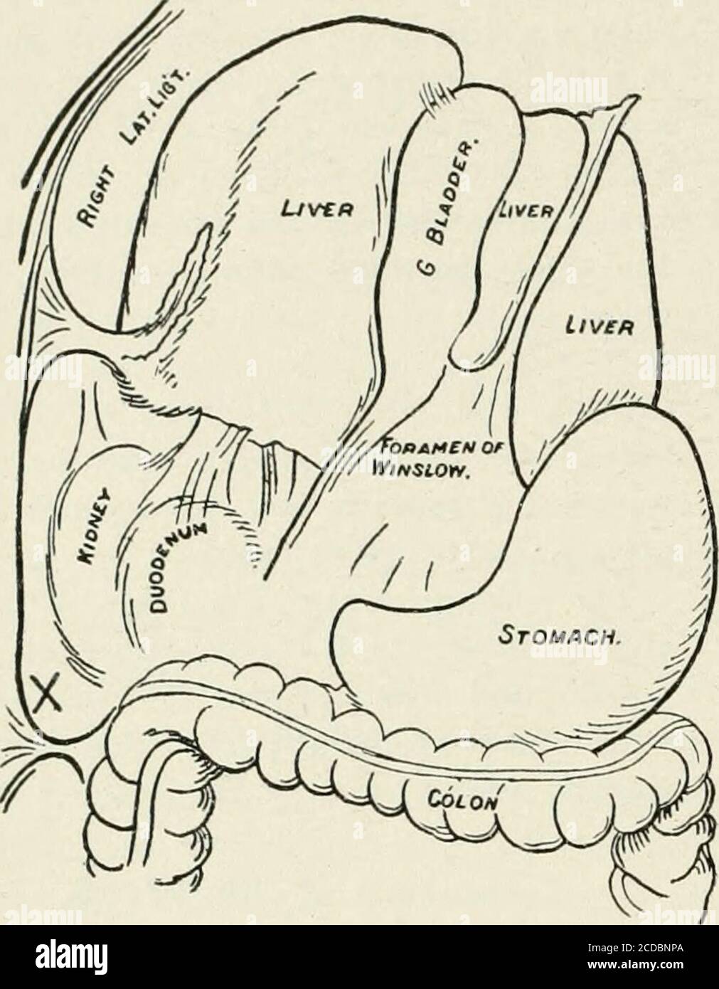 . Annual and analytical cyclopaedia of practical medicine . -formed in ...