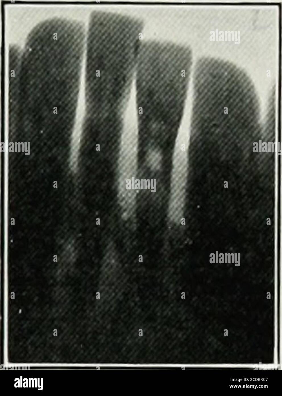 . Periodontal disease and its treatment by ionic medication . Fig. 48 ...