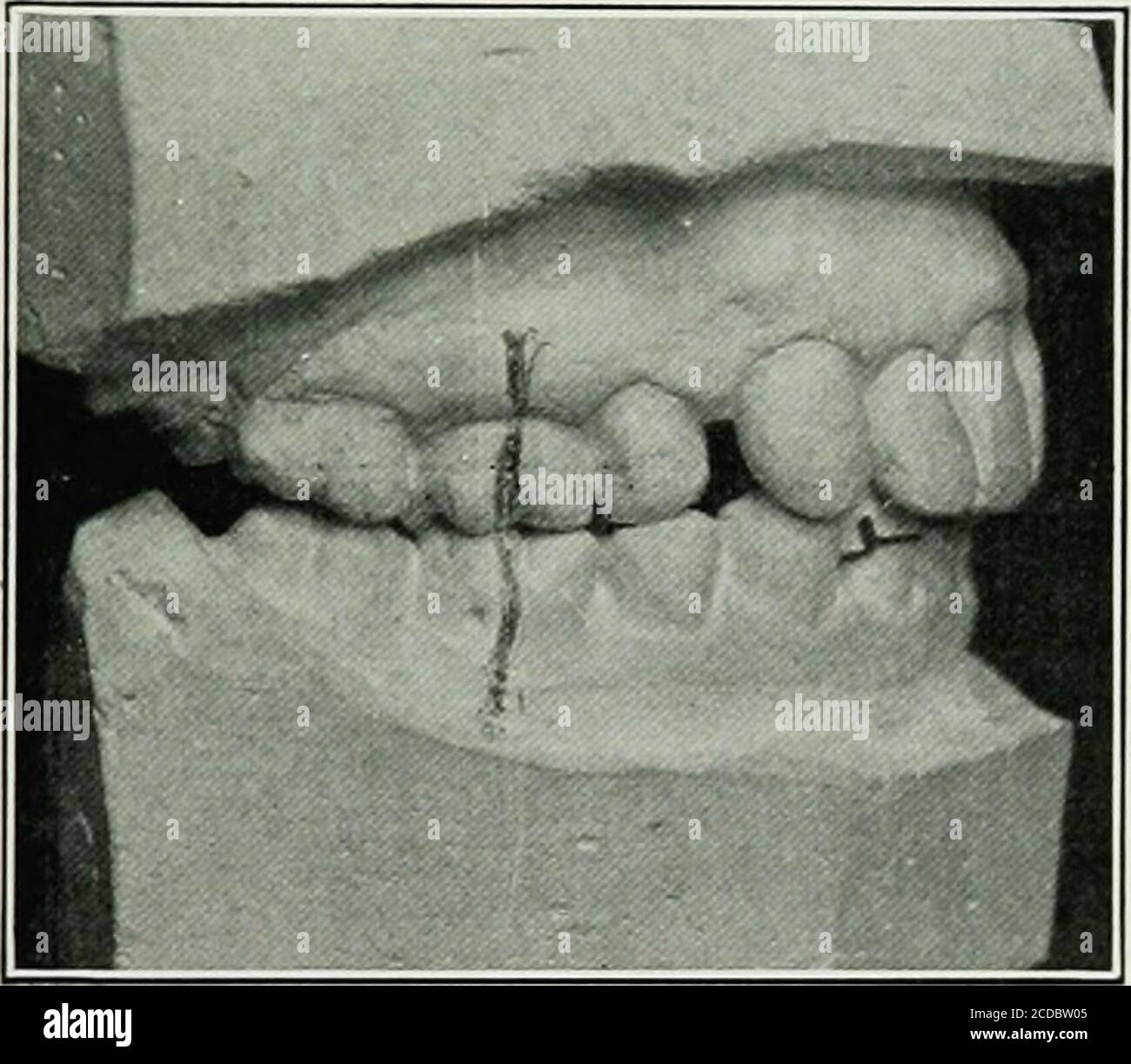 Spaced teeth hi-res stock photography and images - Alamy