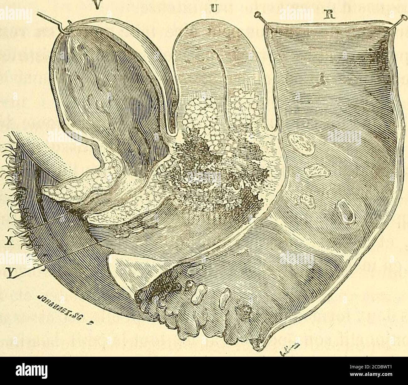 . Manuel d'histologie experimentale . parle tissu carcinomateux ...