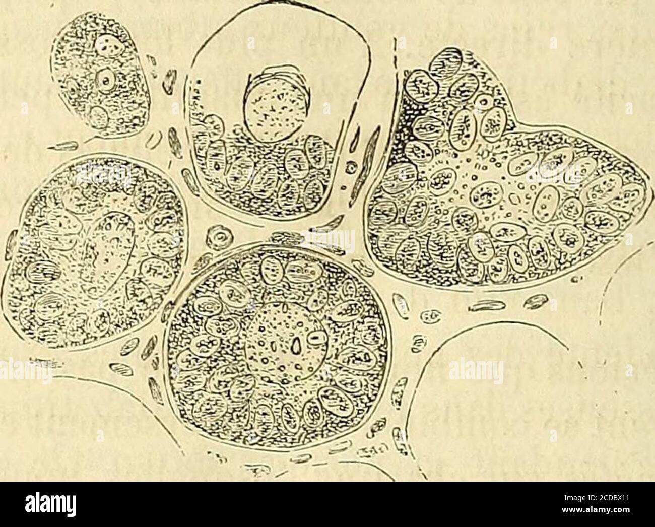 Corticale renale hi-res stock photography and images - Alamy