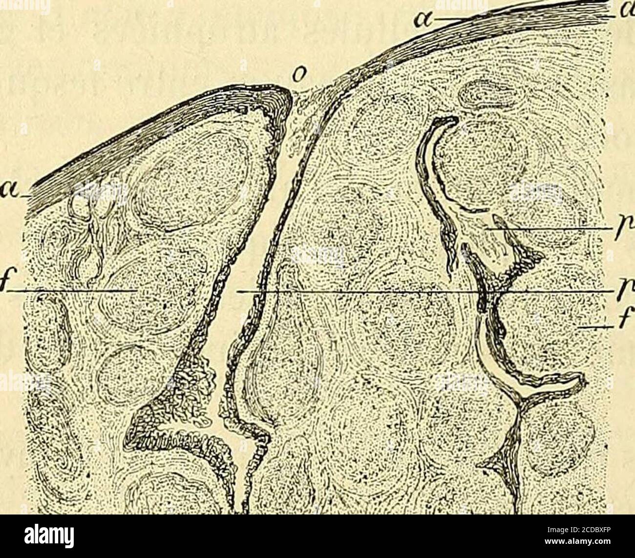 Scrofuleux hi-res stock photography and images - Alamy