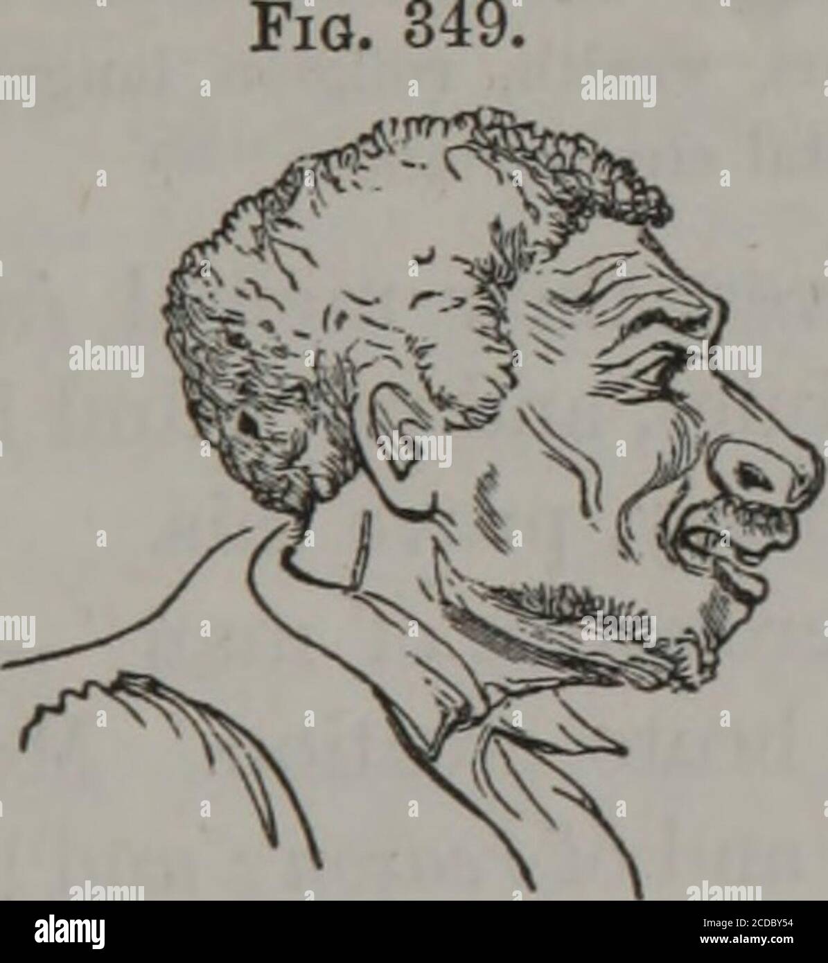 . Types of mankind : or ethnological researches, based upon the ancient ...