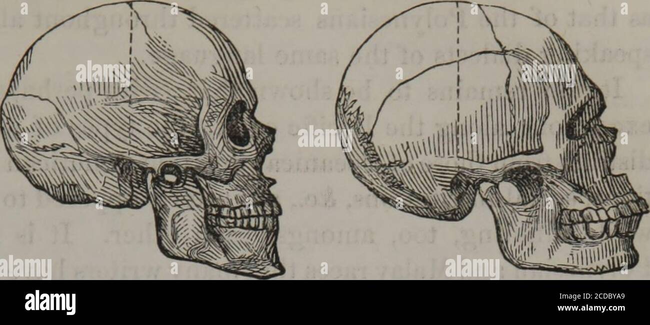 . Types of mankind : or ethnological researches, based upon the ancient ...