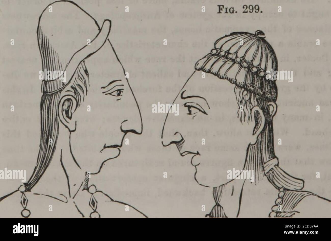 Distorted anatomy hi-res stock photography and images - Alamy