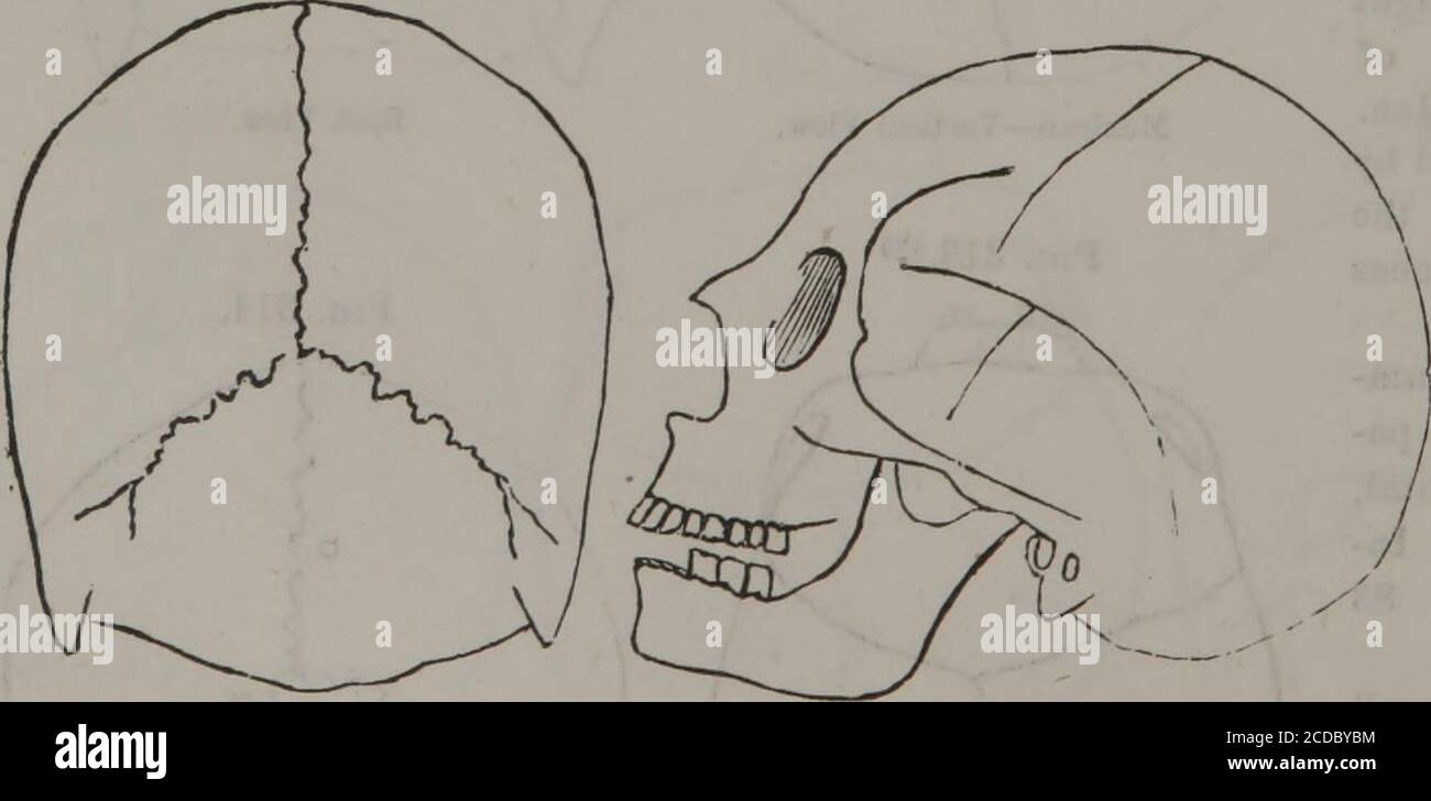 Maximum Skull Breadth
