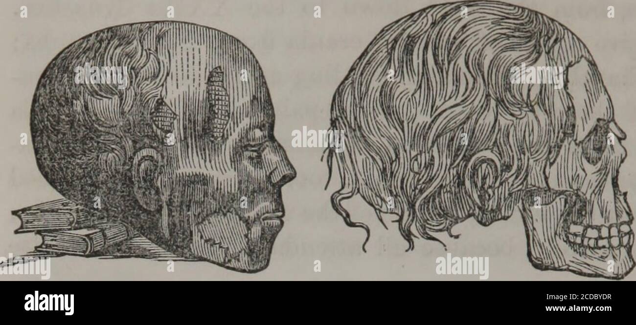 . Types of mankind : or ethnological researches, based upon the ancient ...