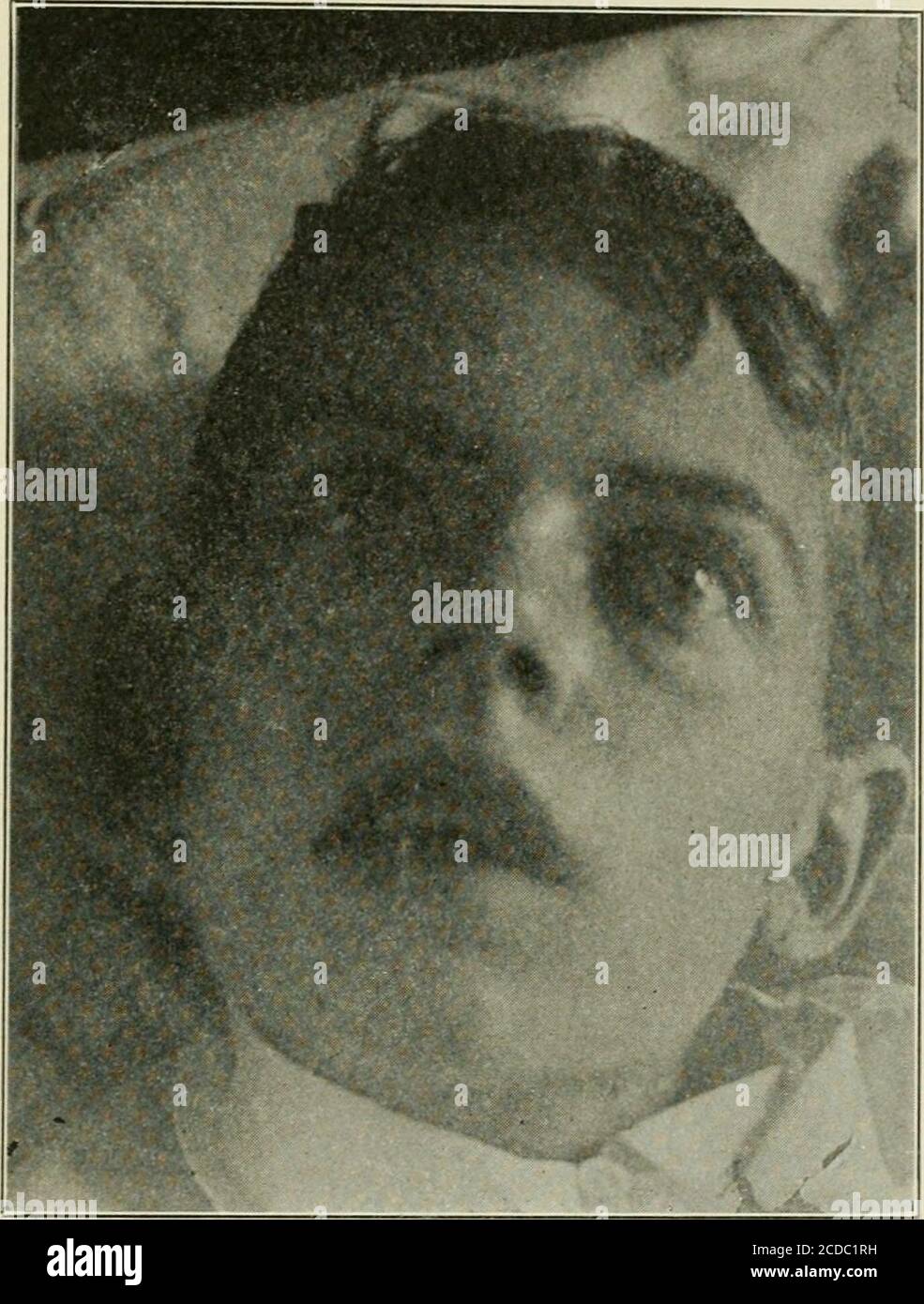 Drooping eyelids hi-res stock photography and images - Alamy