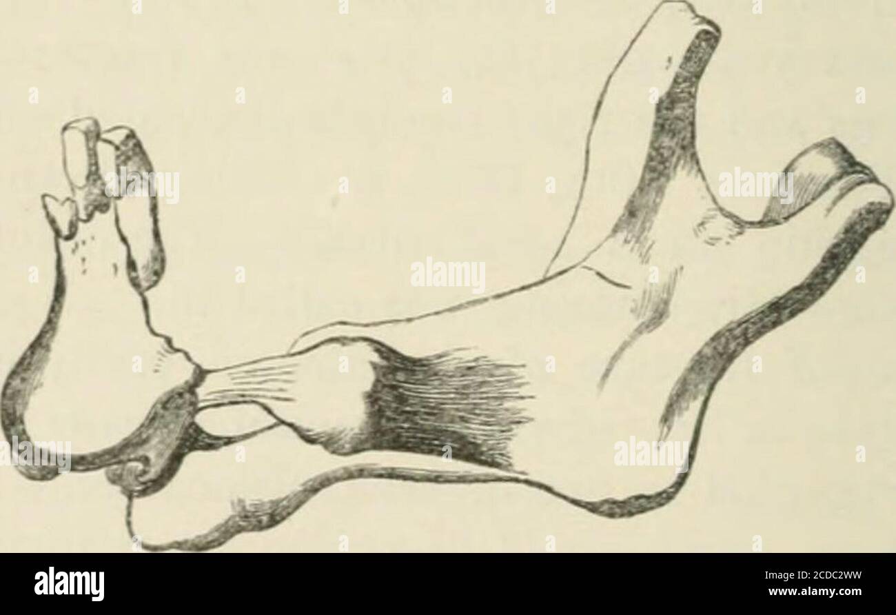 . Injuries and diseases of the jaws . emity of the neck of the lower ...