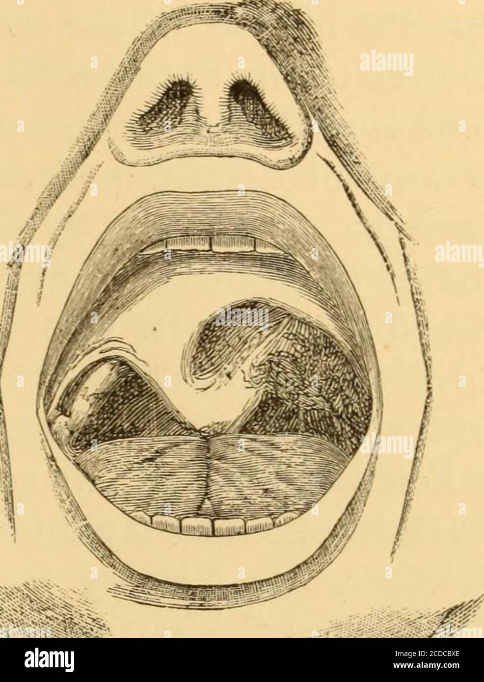 . Diseases of the throat and nasal passages; a guide to the diagnosis ...