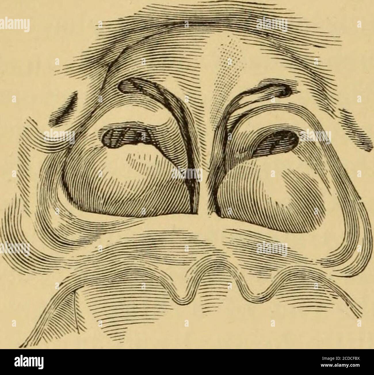 . Diseases of the throat and nasal passages; a guide to the diagnosis ...