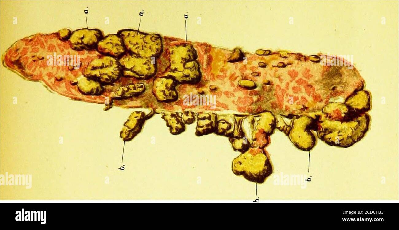 . A practical guide to meat inspection . Fio. 22.—Miliary Tubercle of ...
