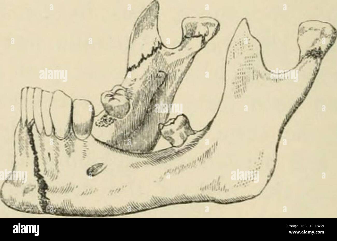 . Injuries and diseases of the jaws . muscles. In the case alluded ...